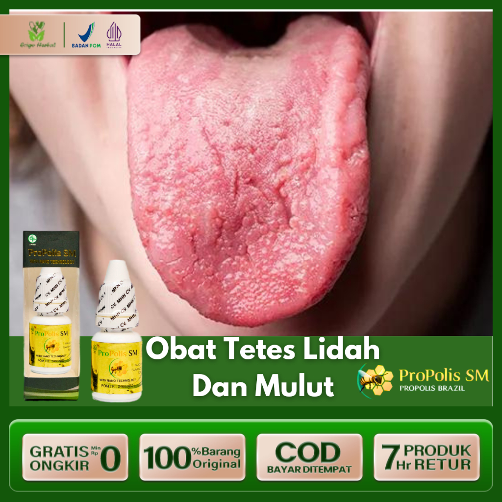 Jual Obat Mulut Bau Busuk, Tetes Lidah Putih, Terasa Pahit, Halitosis ...