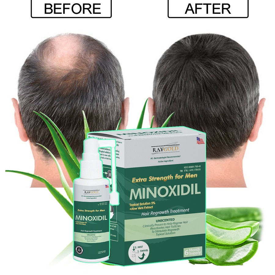 Jual MINOXIDIL 5% penumbuh rambut & brewok with Aloe Vera for MEN made in USA - RAYGOLD - MINOX ...