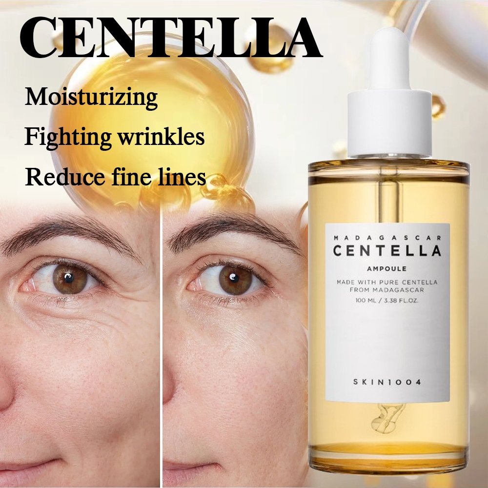 Jual SKIN1004 Madagascar Centella Asiatica Ampoule Serum 100% - ORI ...