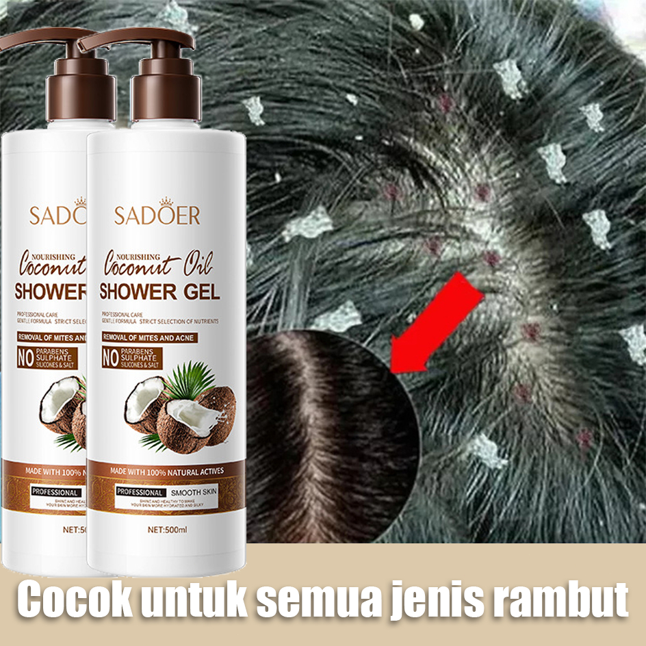 Jual sampo ketombe shampo kutu rambut shampo anti ketombe dan gatal shampoo psoriasis kulit ...