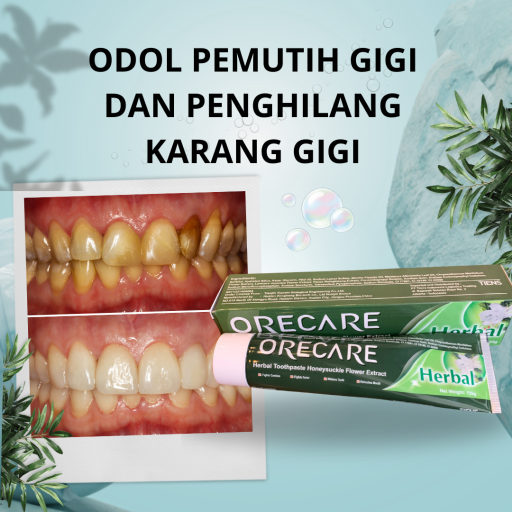 Jual ORECARE HERBAL TOOTHPASTE OBAT PEMUTIH GIGI DAN KARANG GIGI pasta ...
