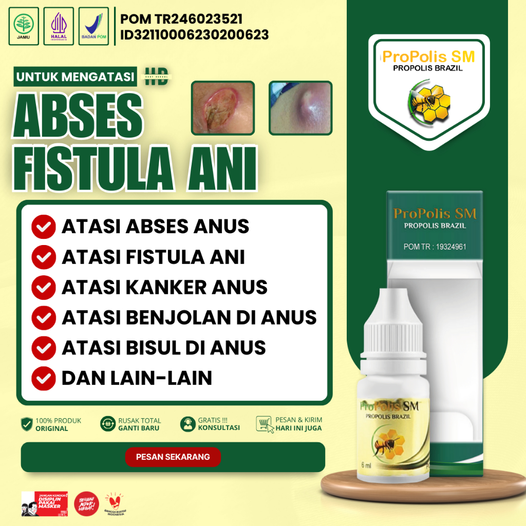 Jual Obat Fistula Ani, Obat Abses Anus, Obat Benjolan Di anus, Obat ...