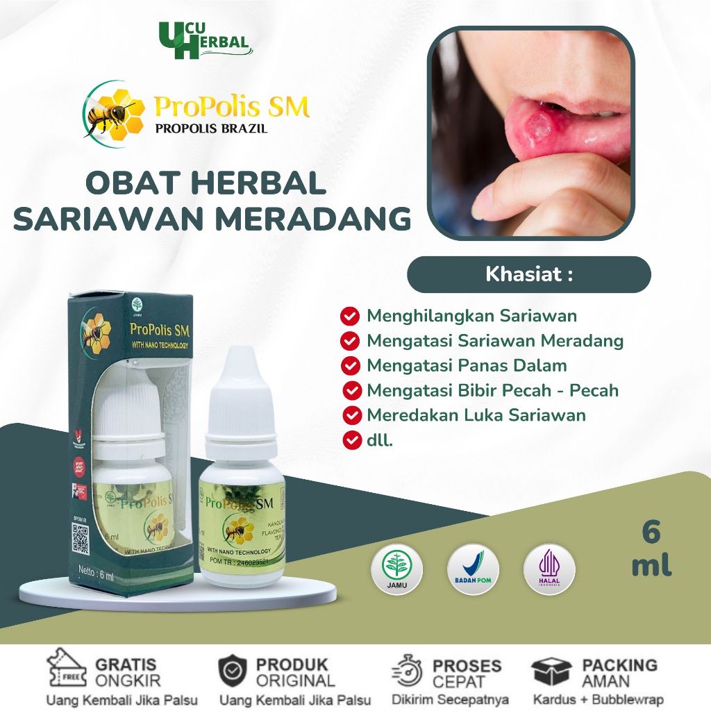 Jual Obat Tetes Sariawan, Obat Sariawan di Bibir, Obat Panas Dalam ...