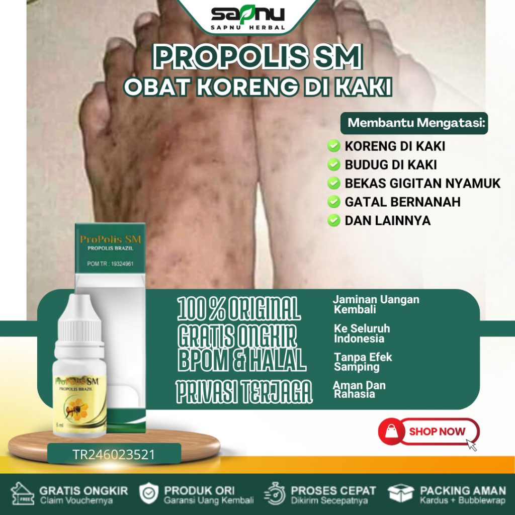Jual Obat Koreng Di Kaki Salep Korengan Koreng Gatal Luka Robek Luka ...