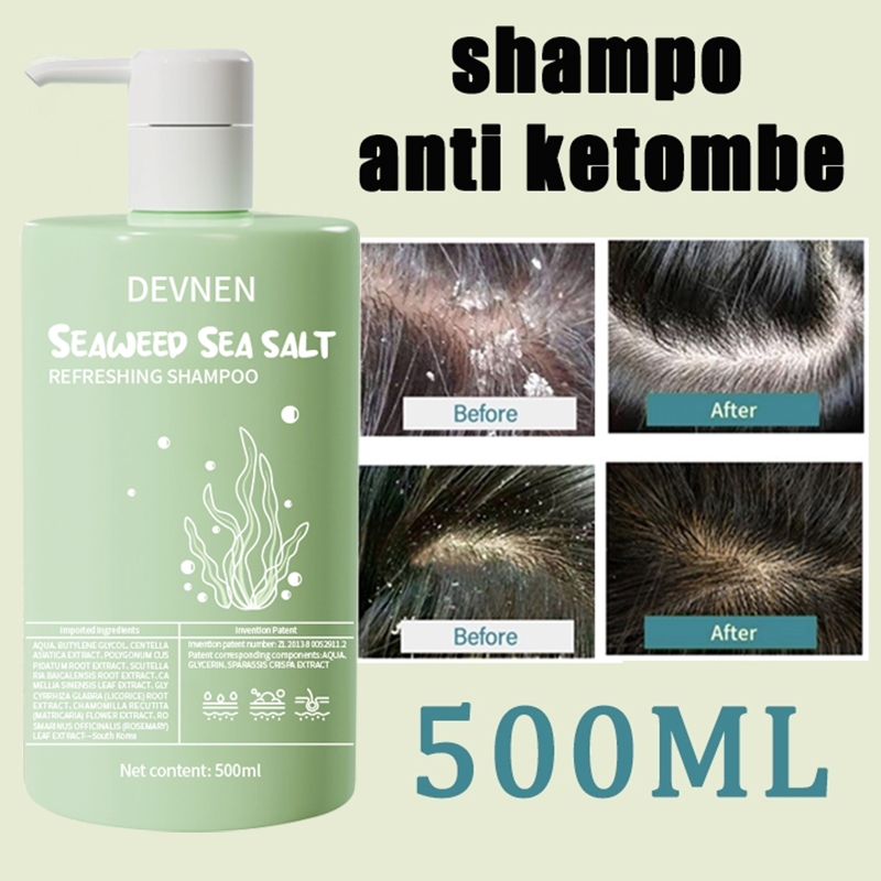 Jual DEVNEN Obat Ketombe Sampo 500ml Garam Laut Buat Ketombe Penghilang Anti Gatal Pengobatan ...