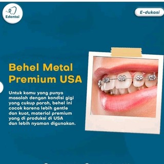 Jual Perawatan Behel Metal Premium USA AO FREE Scaling dan Cetak Gigi ...