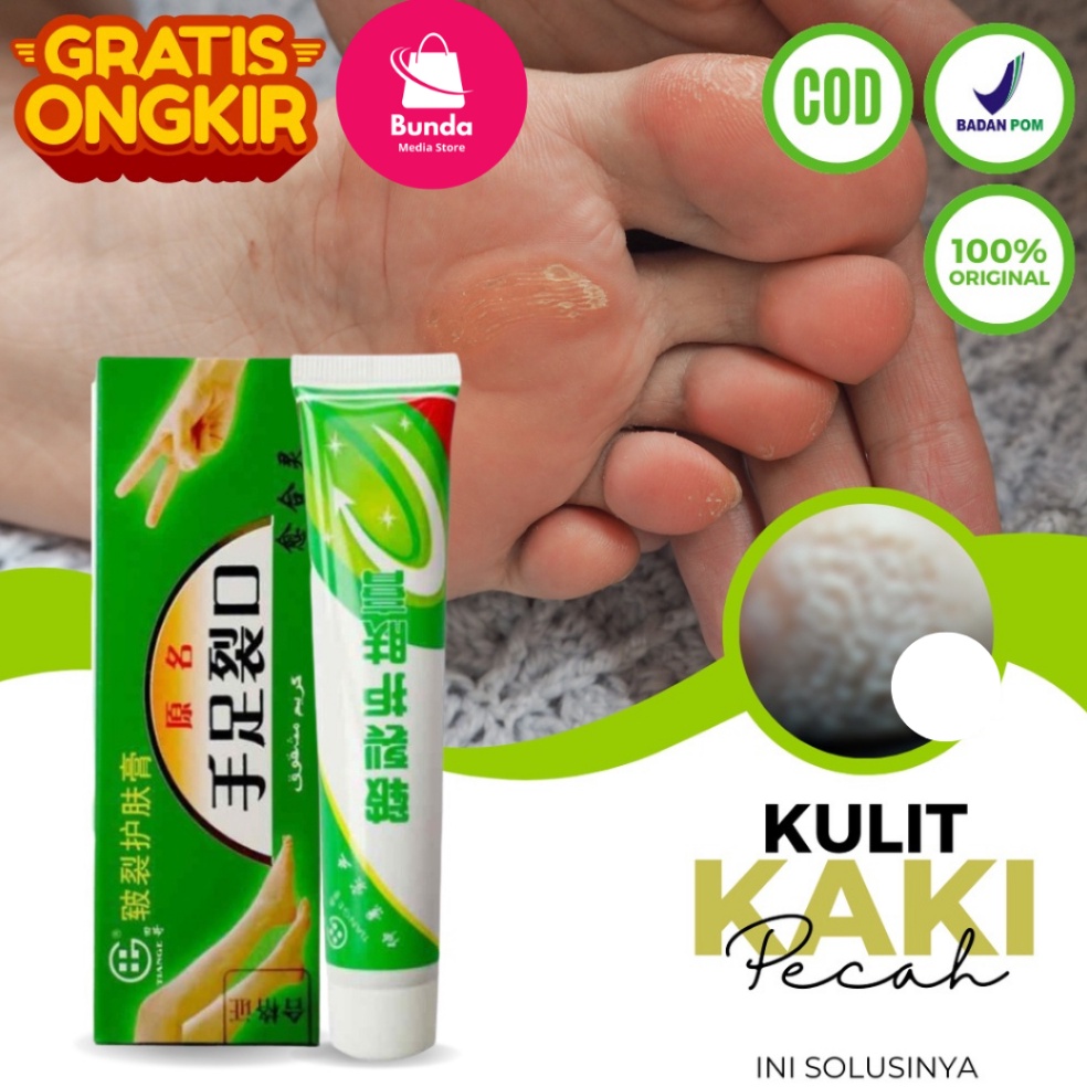 Jual Obat Kaki Rayapan dan Bau Obat Kaki Pecah Pecah dan Kering dan ...