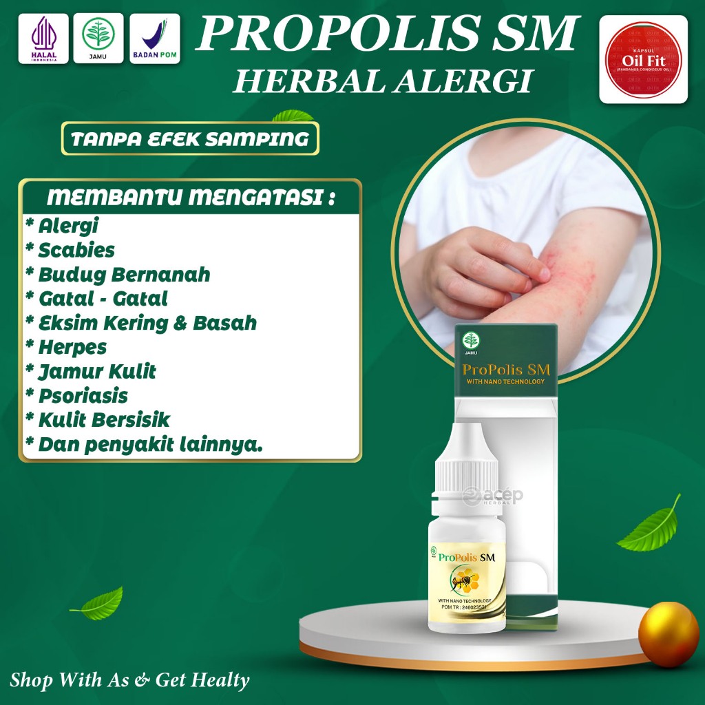 Jual Obat Gatal Kulit Alergi Dingin Biduran Gatal Alergi Herbal Bentol ...