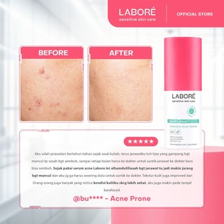 Jual 𝐑𝐀𝐃𝐘𝐒𝐀 - LABORE AcnePro Biome Intensive Acne Serum - Serum ...