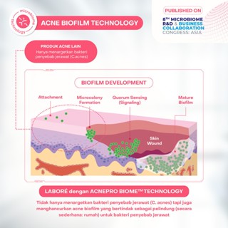 Jual 𝐑𝐀𝐃𝐘𝐒𝐀 - LABORE AcnePro Biome Intensive Acne Serum - Serum ...