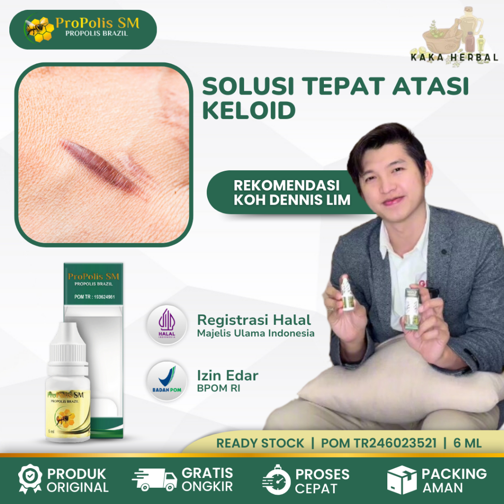 Jual Kaka Herbal - Obat Keloid, Penghilang Keloid, Obat Oles Penghilang ...