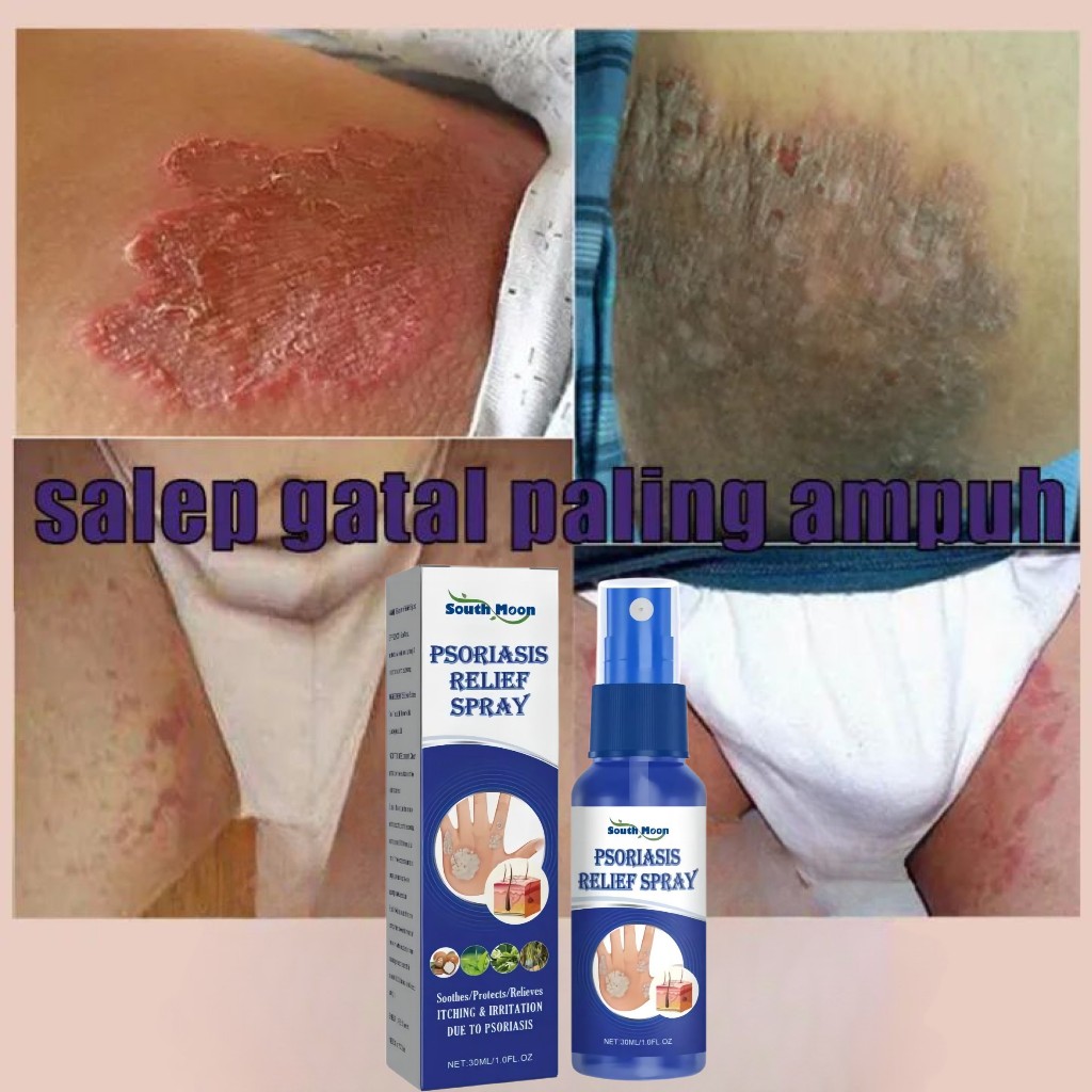 Jual Spray gatal paling ampuh Anti jamur Spray salep gatal selangkangan ...