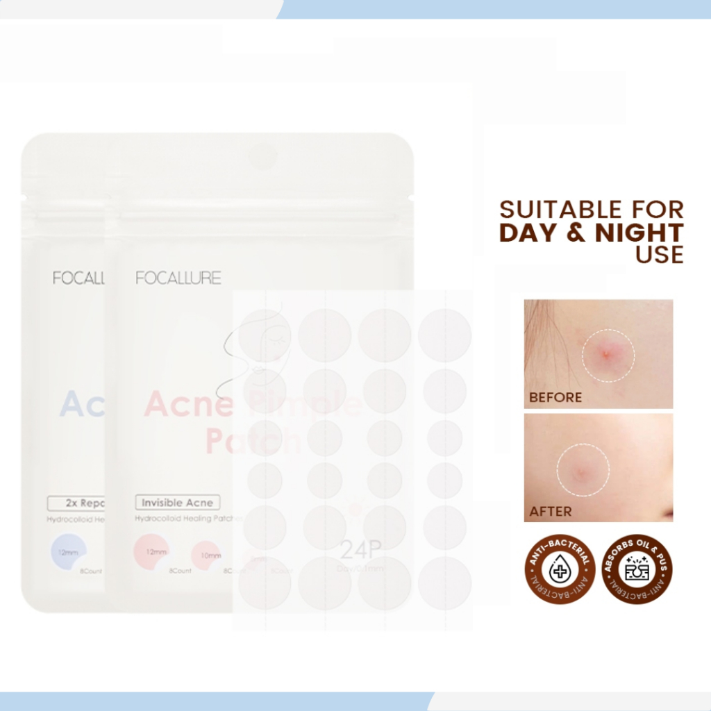 Jual Focallure Spot Acne Patch Treatment Day/Night Waterproof Smooth ...