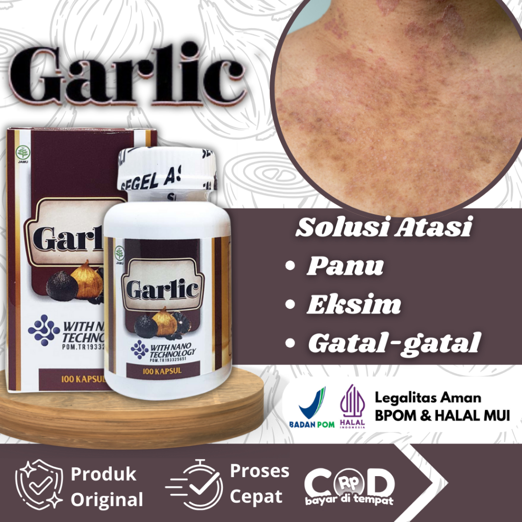 Jual Obat Penghilang Panu, Bercak Putih di Kulit, Panu, Eksim, Hapuran ...
