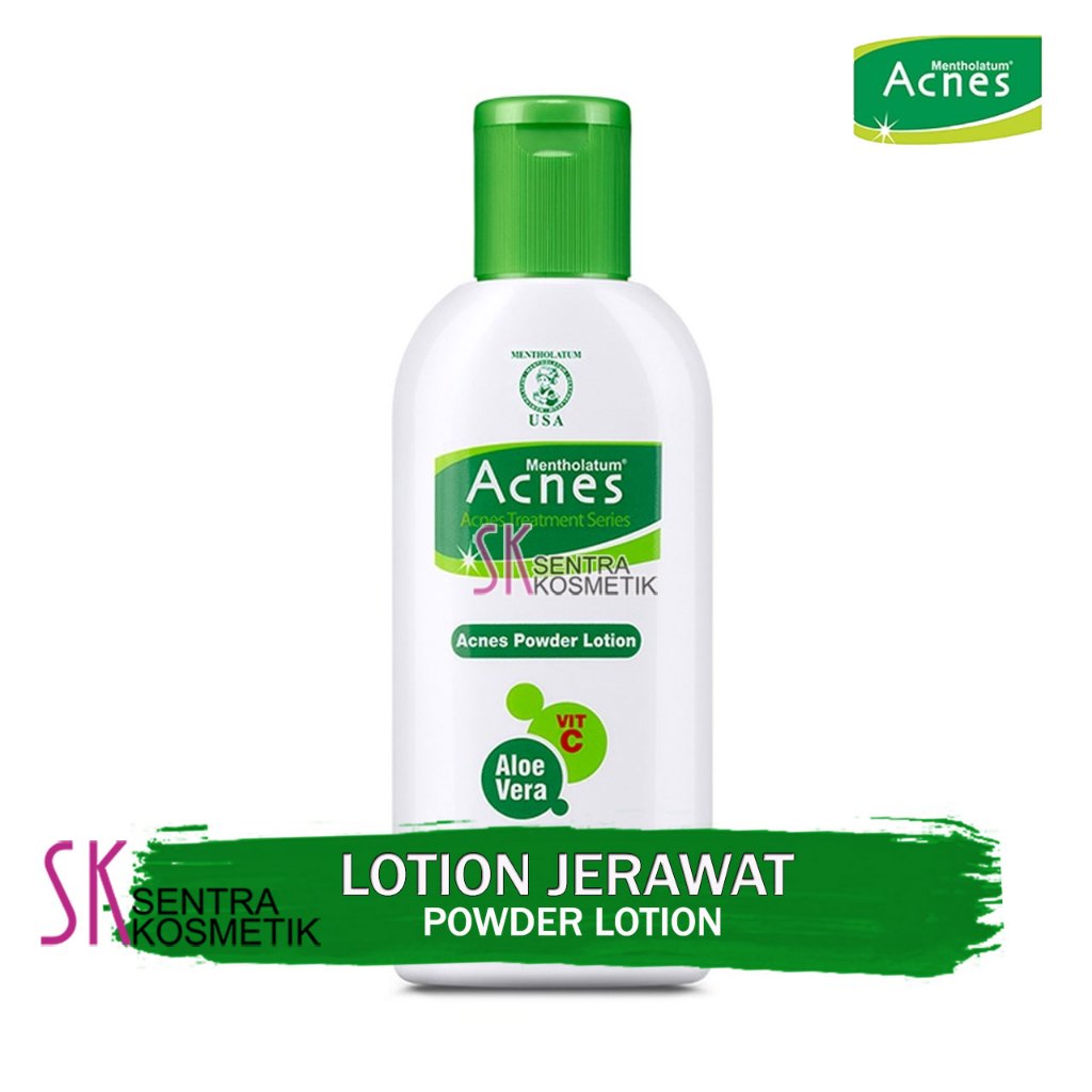 Jual ACNES Powder Lotion 100ml Lotion Jerawat | Shopee Indonesia