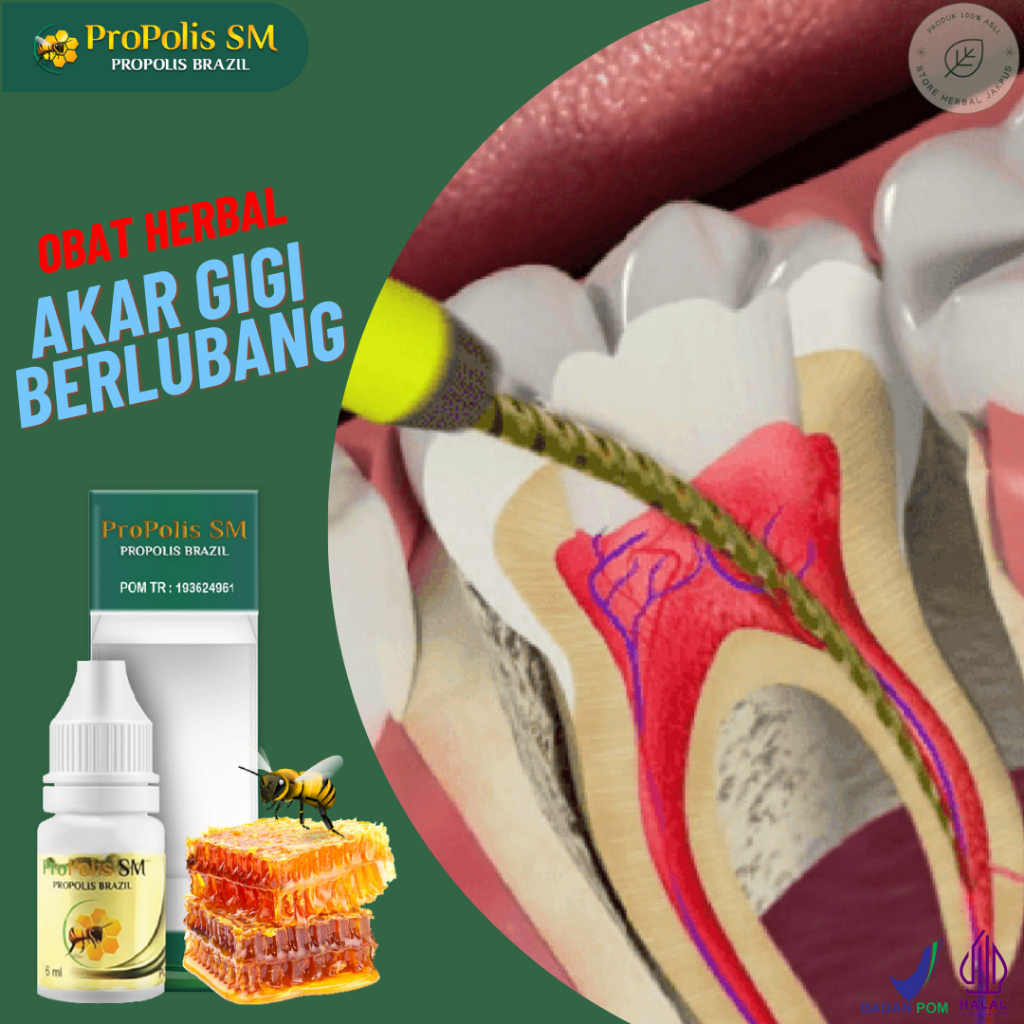 Jual Obat Perontok Akar Gigi Ulat Gigi Berlubang Penghilang Daging Jadi ...