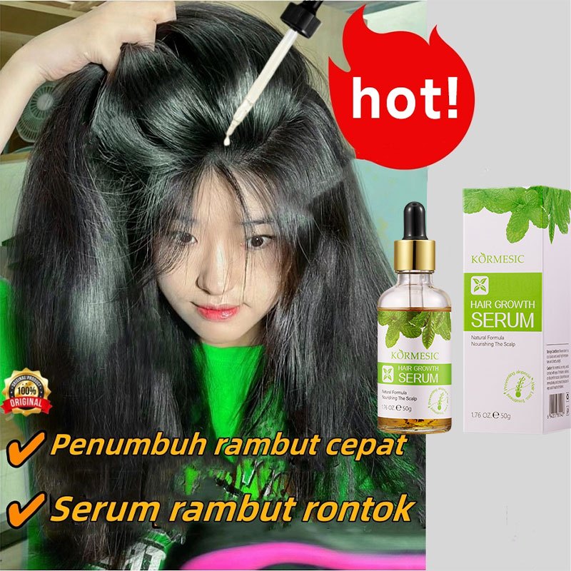 Jual Penumbuh rambut rontok Serum Penumbuh Rambut Anti Botak Penumbuh ...