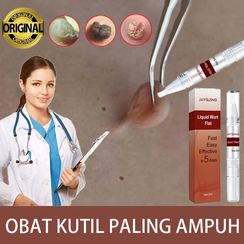 Jual obat penghilang tahi lalat Penghilang Kutil Dan Tahi Lalat ...