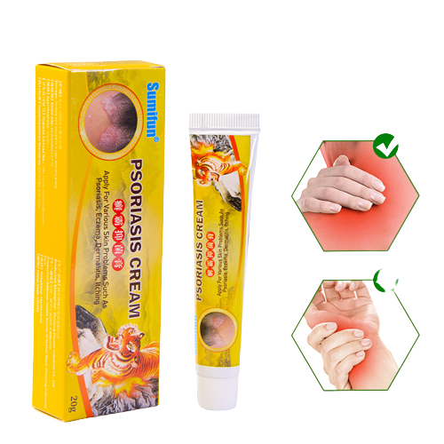 Jual Khusus Psoriasis Salep Krim Herbal Untuk Eksim Psoriasis Panu ...