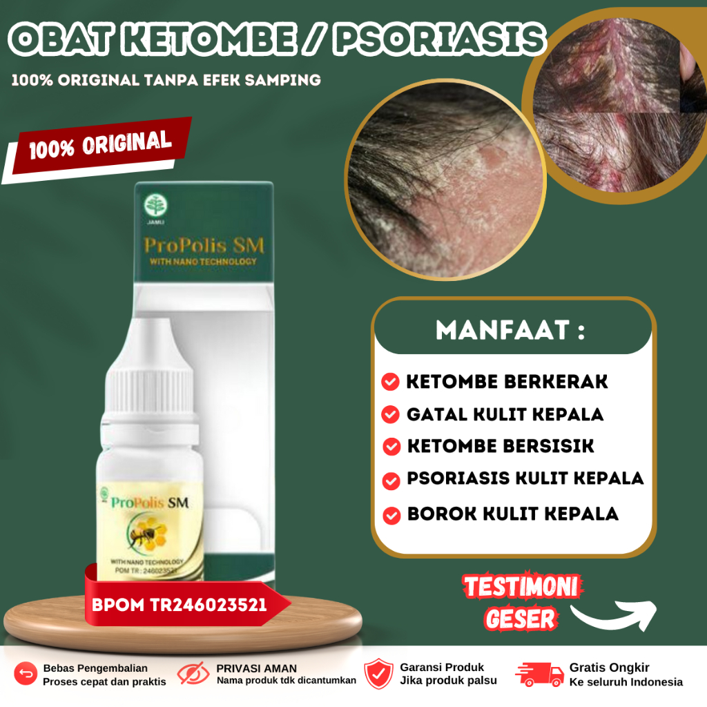 Jual Obat ketombe rambut berkerak ketombe bersisik parah psoriasis kulit kepala borok kulit ...