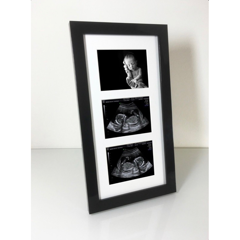 Jual Baby Ultrasound Frame | Bingkai Foto USG Trimester | Shopee Indonesia