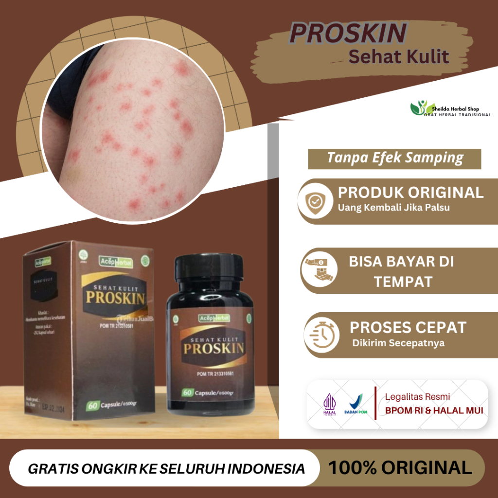 Jual Proskin Gatal Tungau Kasur, Alergi Debu Kasur, Bintik Gatak Bekas ...