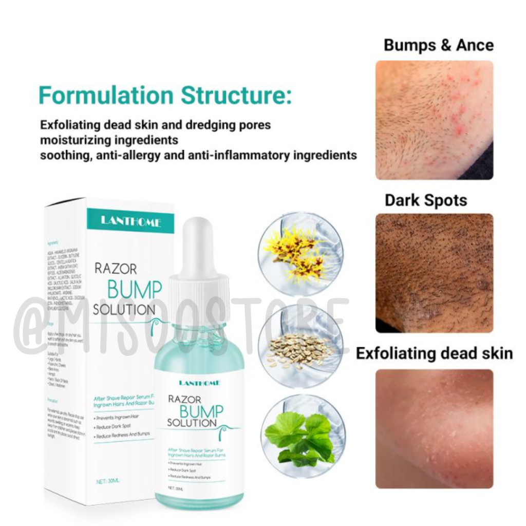 Jual Lanthome razor bump solution 30ml serum untuk ingrown hair/razor ...