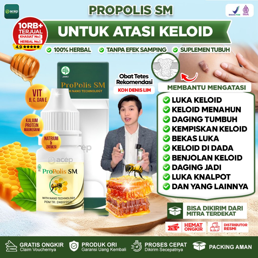 Jual Obat Keloid Daging Tumbuh Daging Jadi Penghilang Keloid Luka Tindik Di Telinga Bekas ...