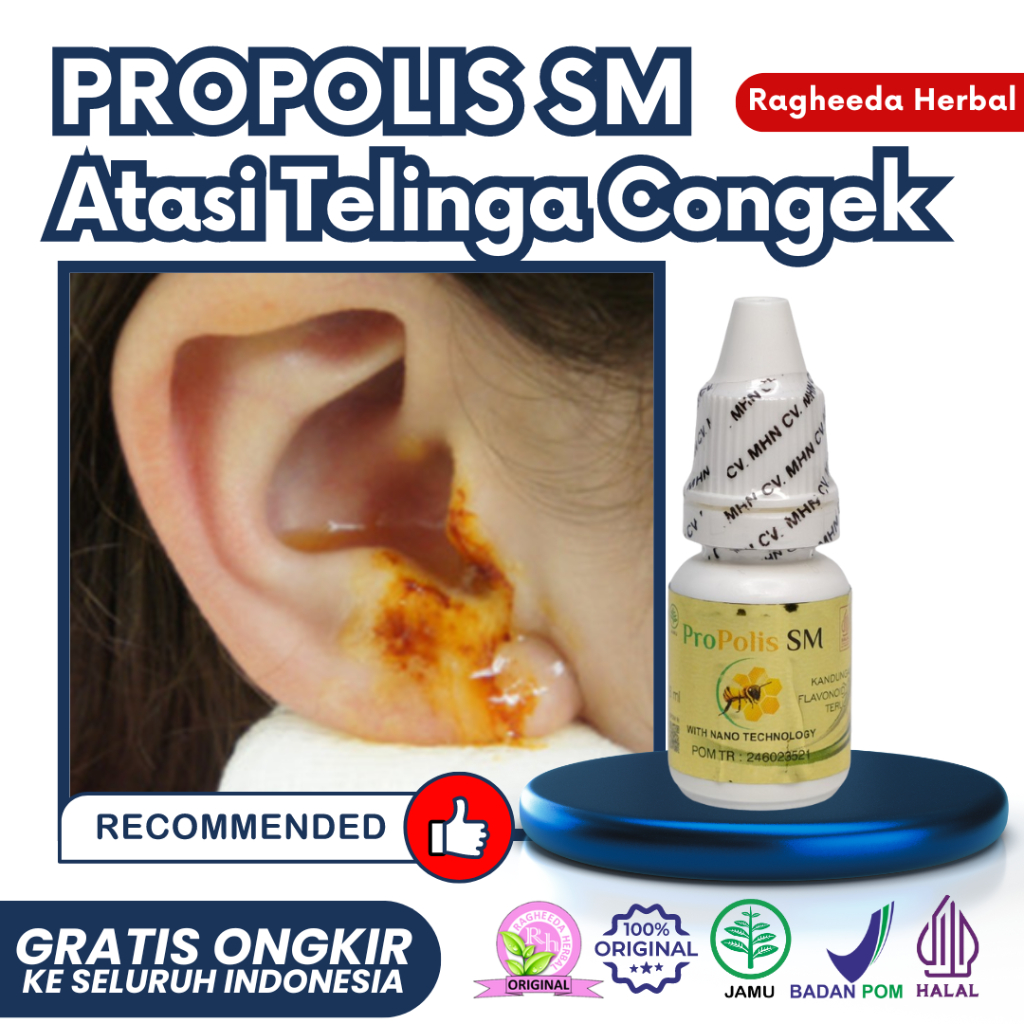 Jual Propolis Obat Penyakit Congek Curek Telinga Berdengung, Berdenging ...