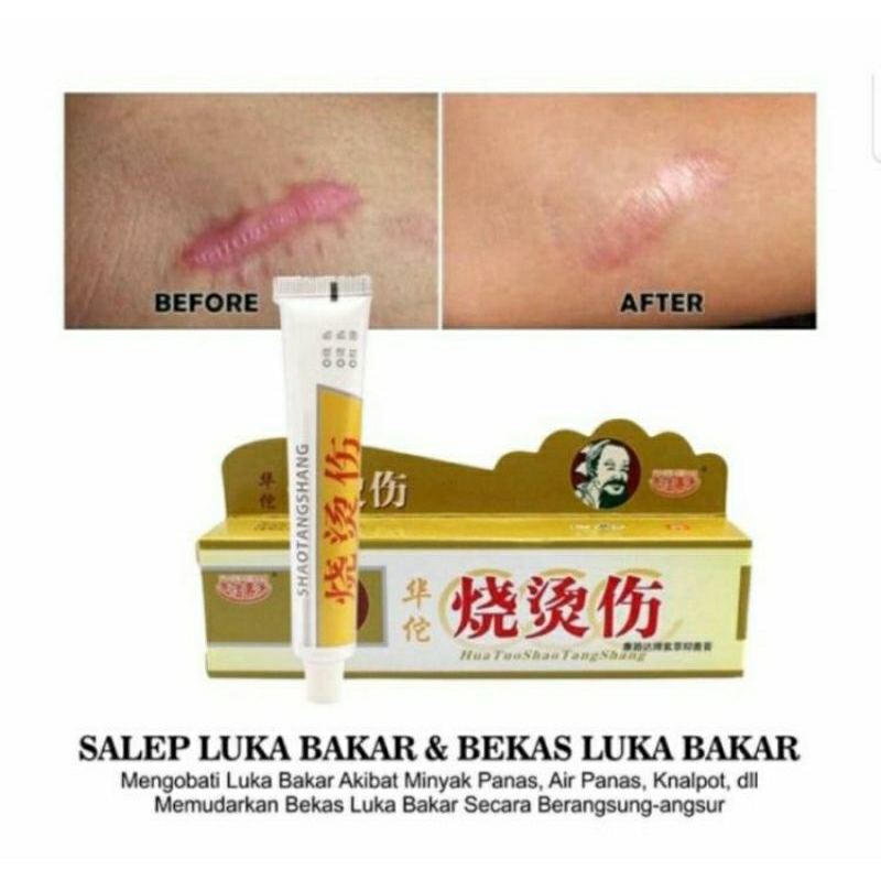 Jual shao tang shang original salep luka bakar dan keloid/bekas luka ...