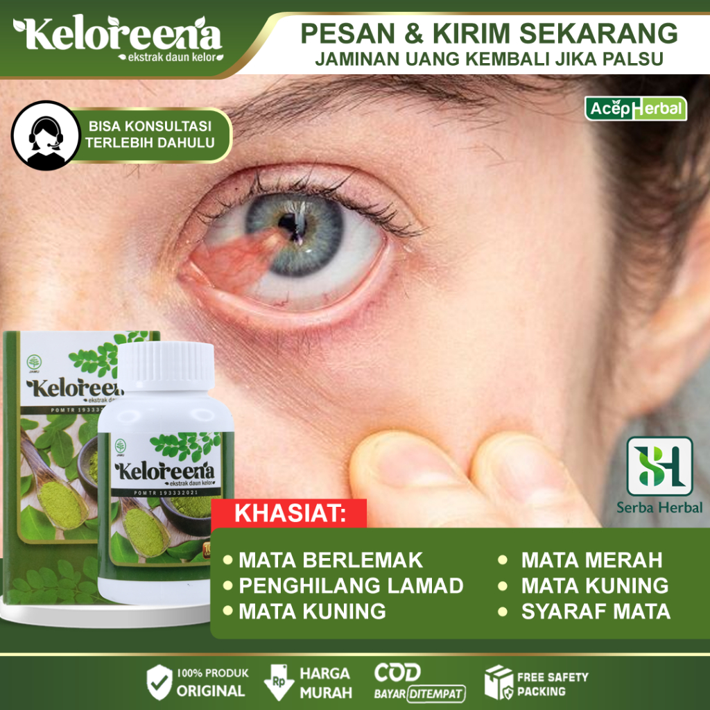Jual Obat Mata Berlemak Pterigium Glukoma Katarak Ada Selaput di Bagian ...