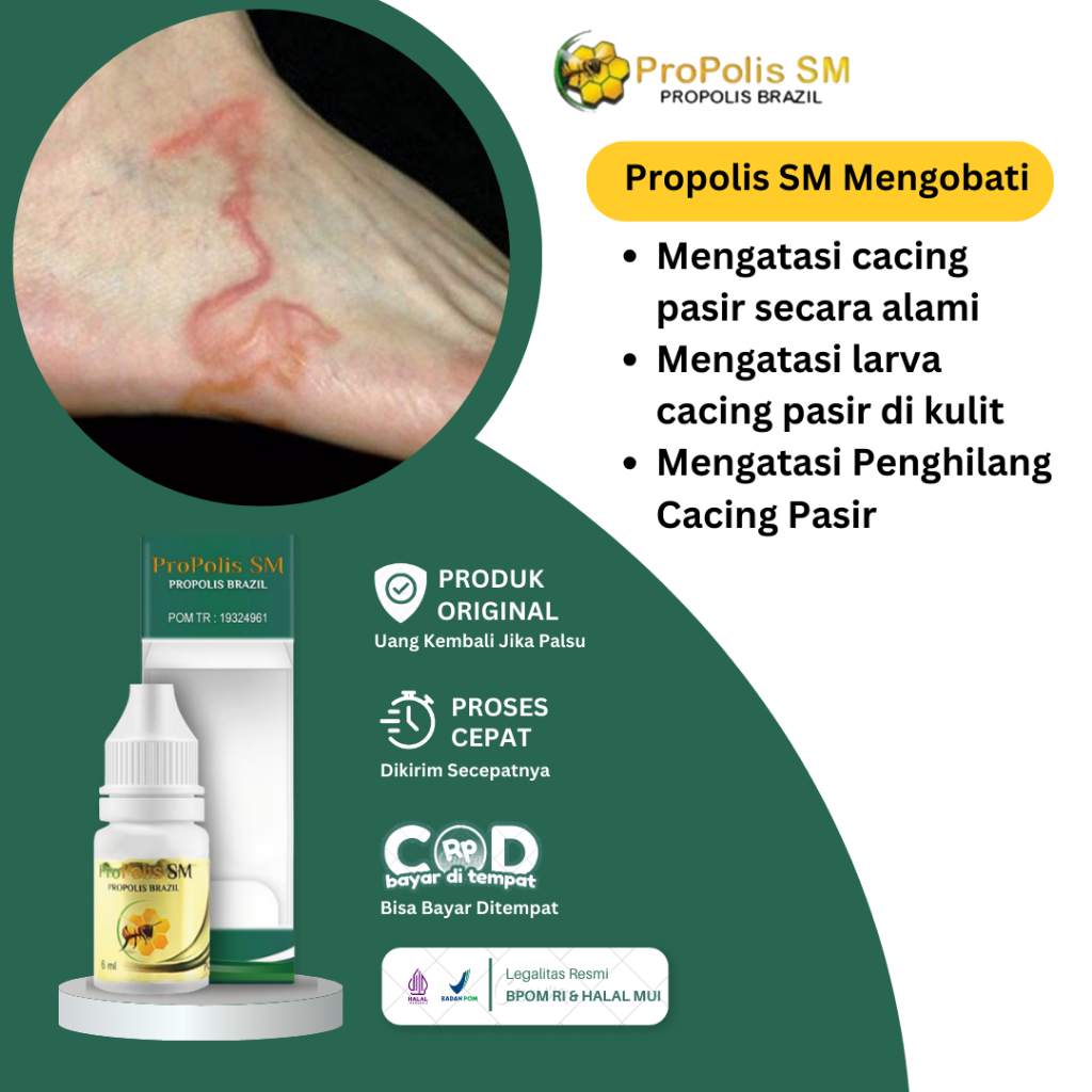 Jual Obat Cacing Pasir, Infeksi Di Kulit Akibat Cacing Pasir, Cacing ...