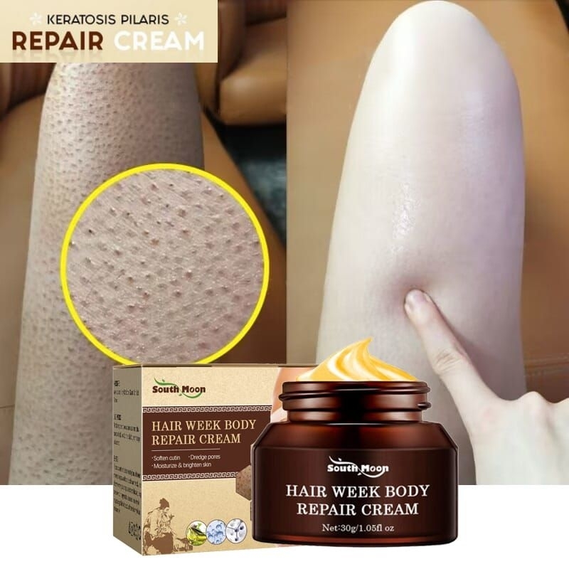 Jual 100 Asli Exp 2026. Chicken Skin Krim Pelembab Penghilang Kulit Ayam 30G Shopee Indonesia