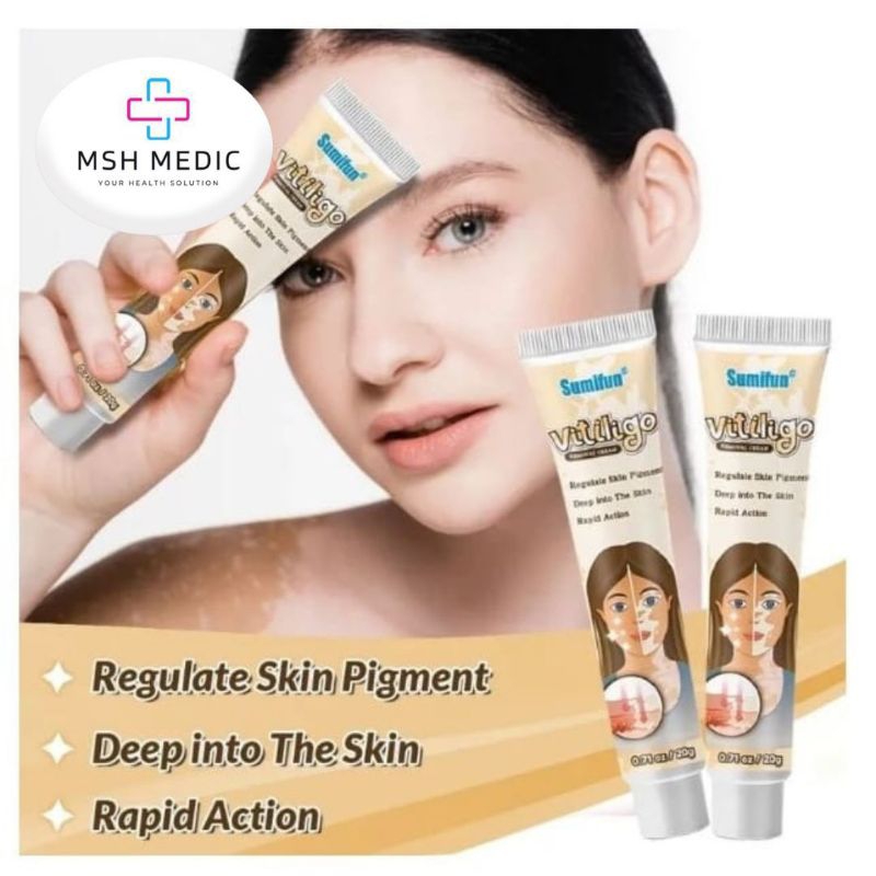 Jual Sumiffun Salep Kulit Vitiligo - Bintik Bercak Kulit Belang ...