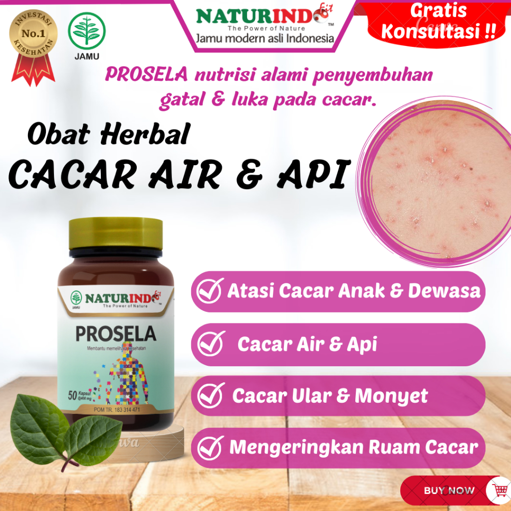 Jual Obat Cacar Air Api Ular Anak Dewasa Ampuh Bintik Merah Ruam Kulit ...