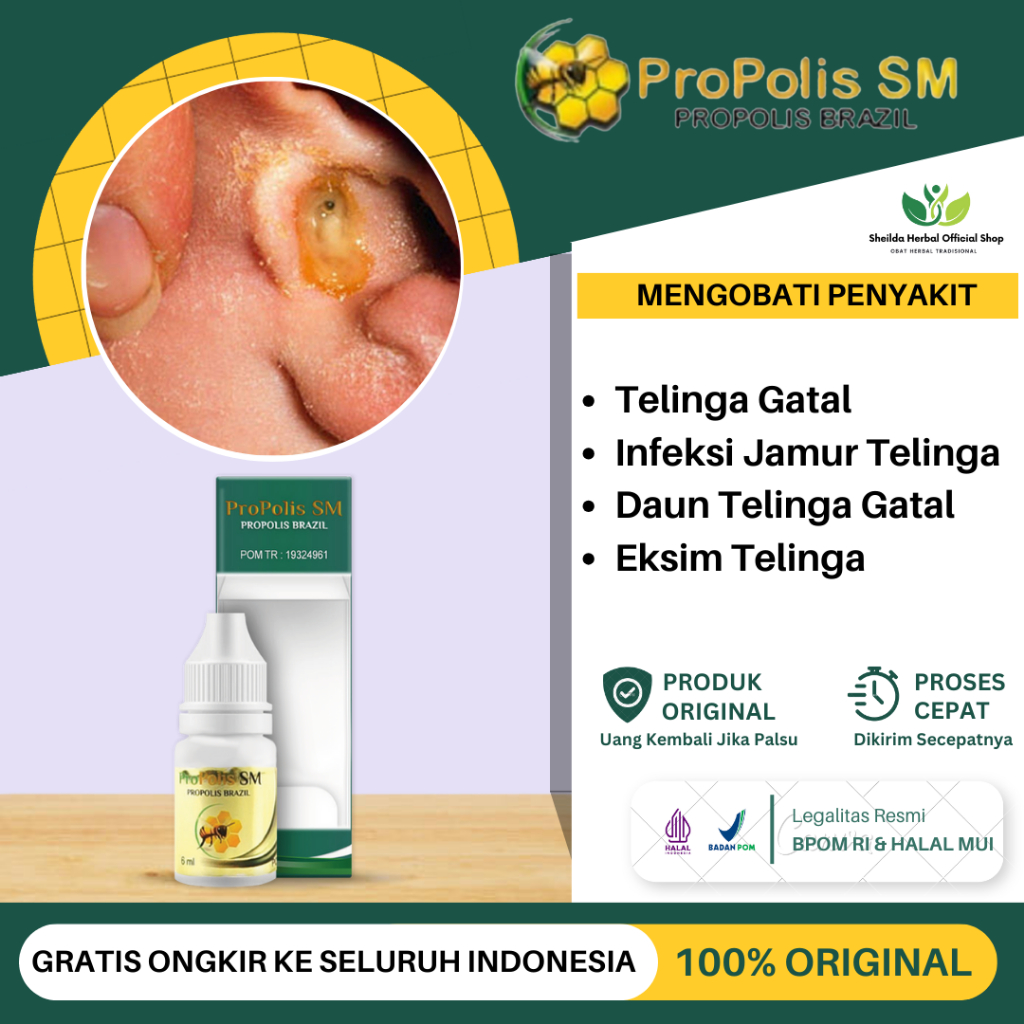 Jual Obat Telinga Gatal, Obat Daun Telinga Gatal, Telinga Gatal Dan ...