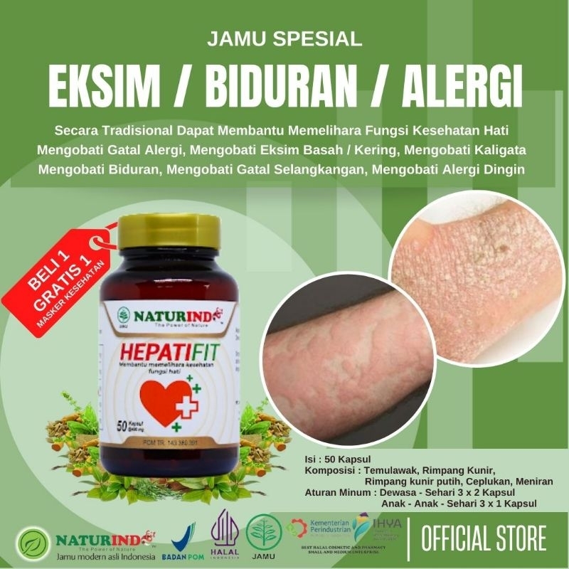 Jual Obat Biduran Gatal Alergi Kaligata Dan Eksim Anak dan Dewasa ...