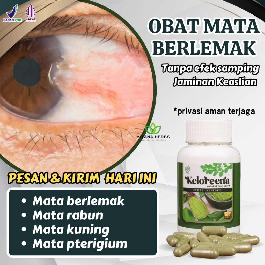 Jual Mitana Herbal / Obat Mata Berlemak / Obat Lemak Mata / Obat Mata ...