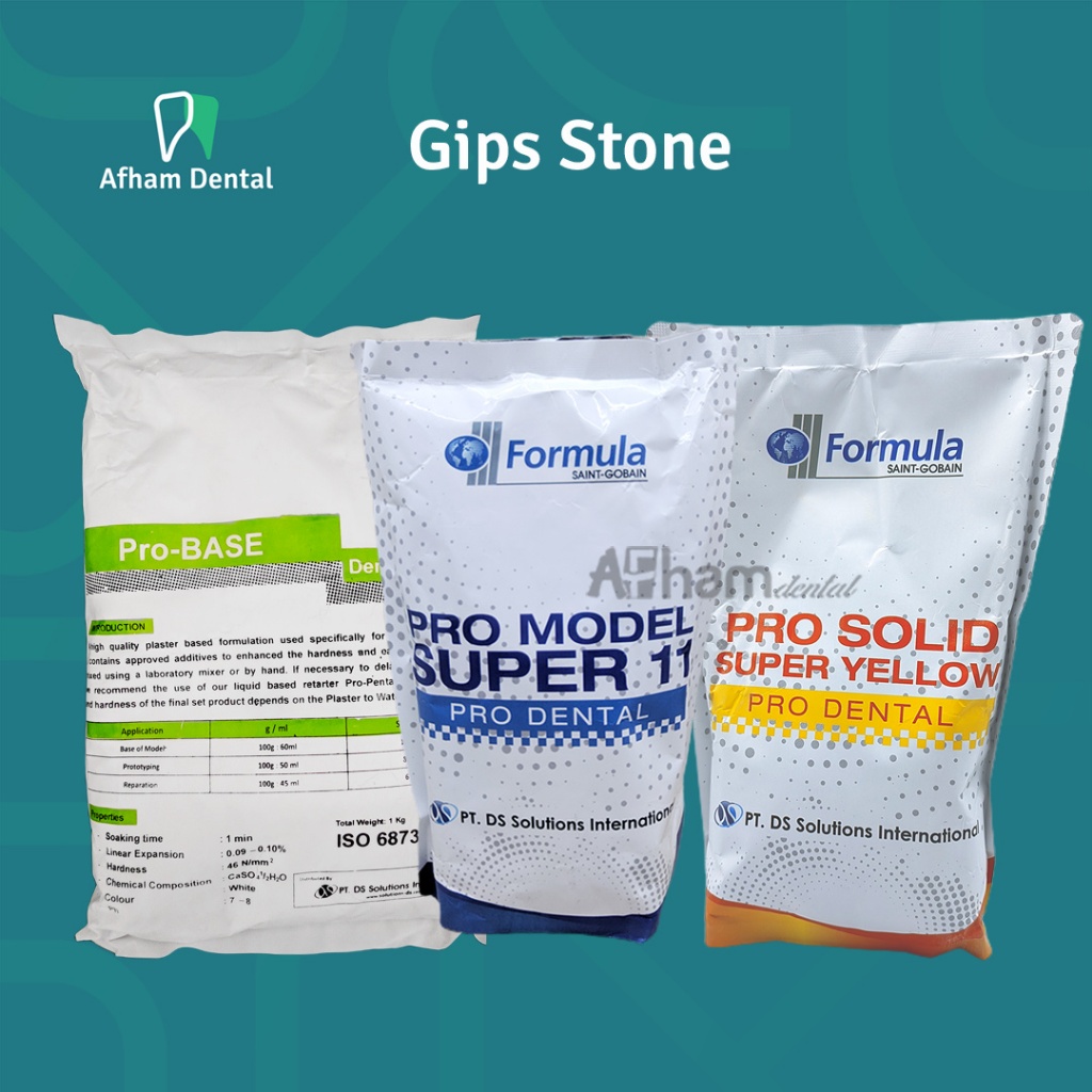 Jual GIPS STONE MOLDANO PROBASE TYPE 1,2,DAN 3 | Shopee Indonesia