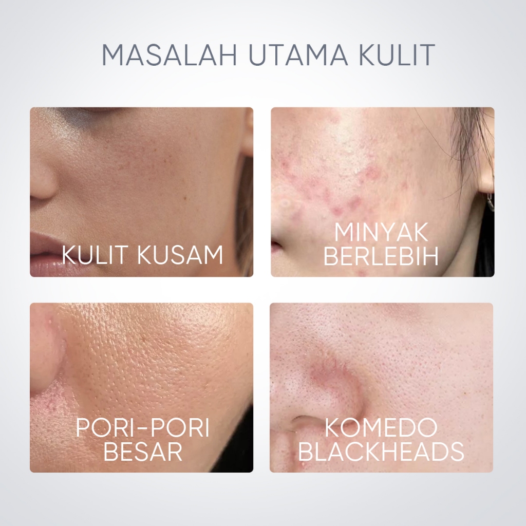 Jual SKINTIFIC - Alaska Volcano Pore Clay Stick 40g | Masker Wajah ...