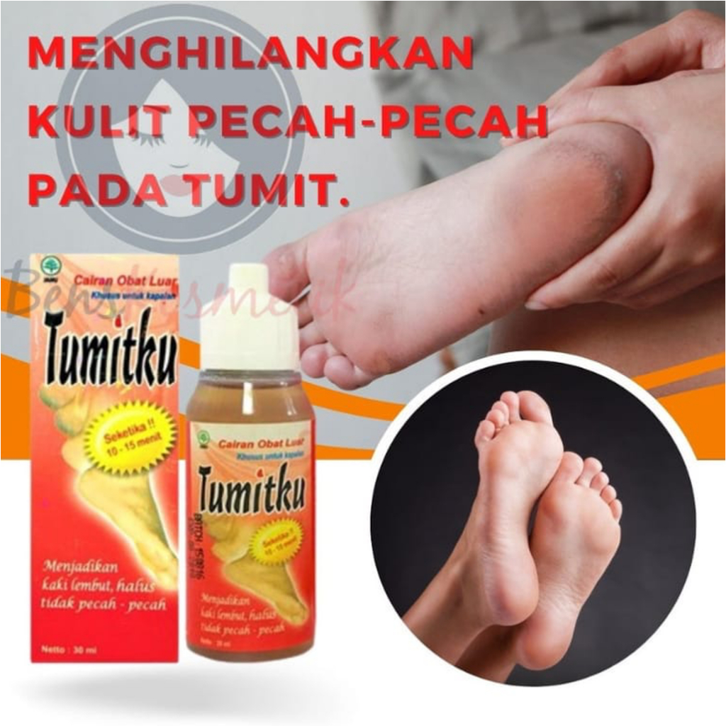 Jual TUMITKU OBAT KAKI PECAH Original BPOM Solusi KAKI PECAH DAN ...