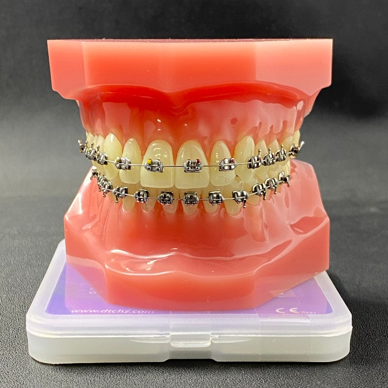 Jual Bracket Zeal Plus DTC (KUALITAS PREMIUM) BEHEL GIGI/BRACKET BEHEL ...