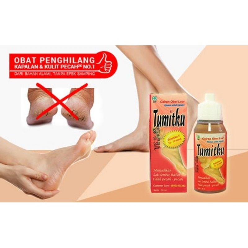 Jual Tumitku Obat Kaki Pecah Pecah Original 30ml Kepalan dan Pelembut ...