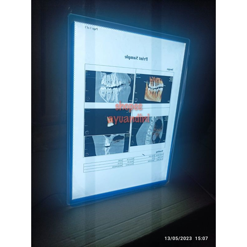 Jual New Dental viewer X ray LED rontgen slim portable A4 | Shopee ...