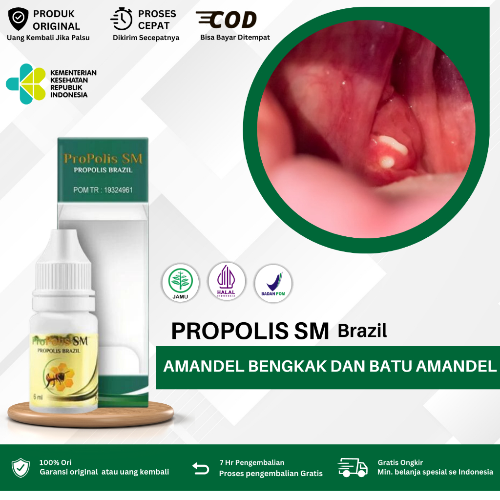 Jual Obat Radang Amandel, Obat Sakit Amandel Anak dan Dewasa, Gondokan ...