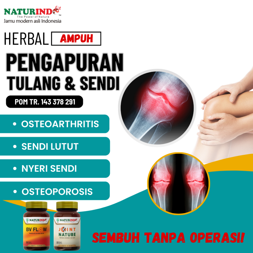Jual Obat Herbal Pengapuran Tulang dan Nyeri Sendi Lutut Osteoarthritis ...