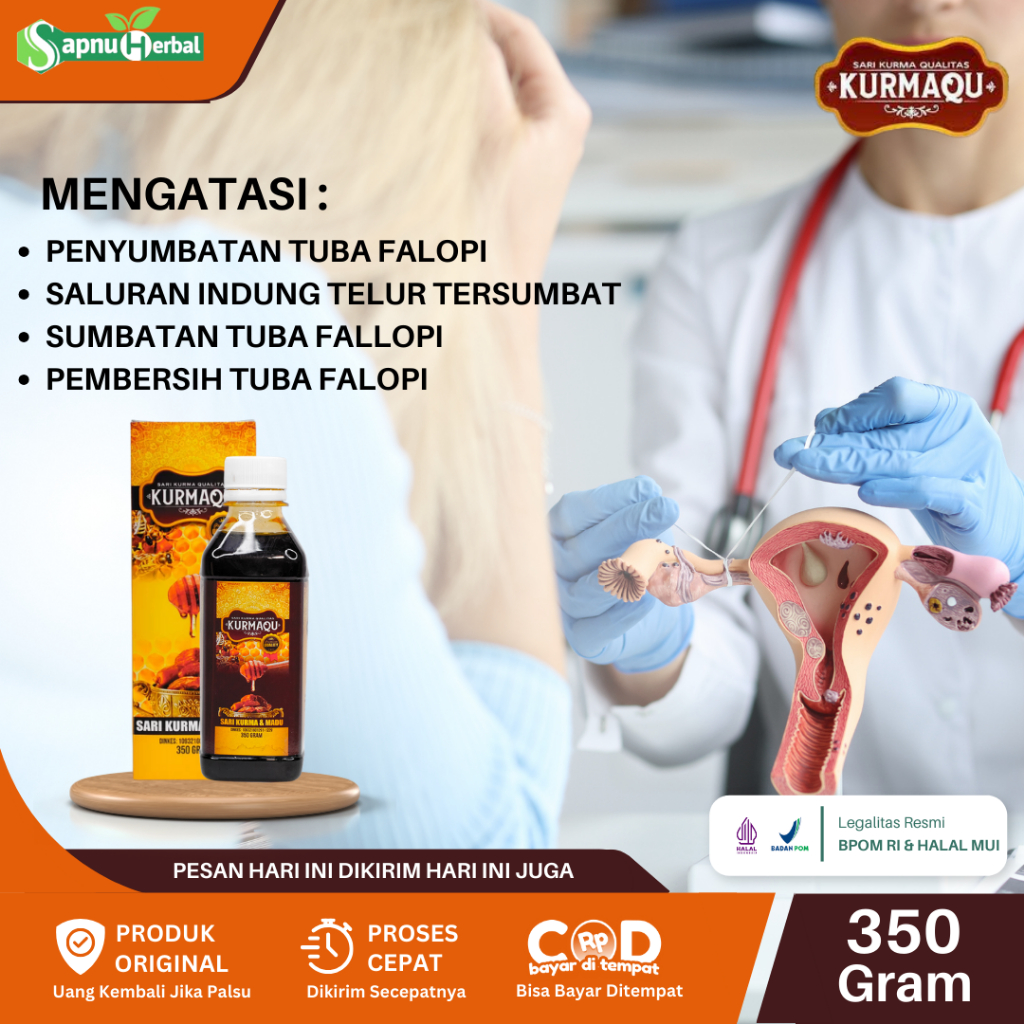 Jual Obat Tuba Falopi Tersumbat, Obat Penyumbatan Tuba Palopi ...