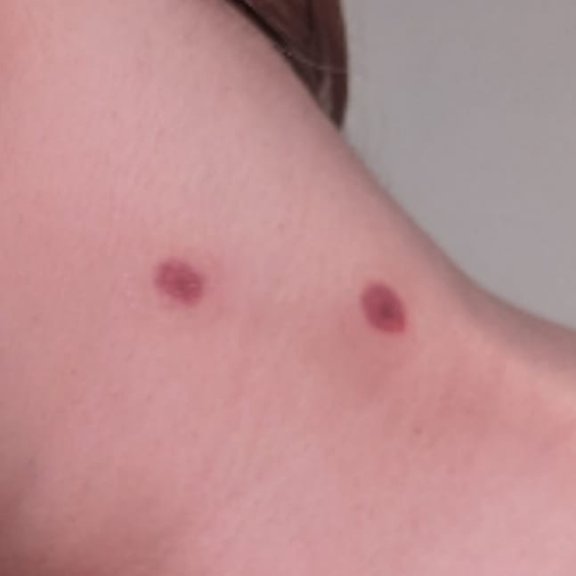 Jual [PRODUK LOKAL] TEMPORER TATO LUKA GIGITAN VAMPIR | VAMPIRE BITE ...