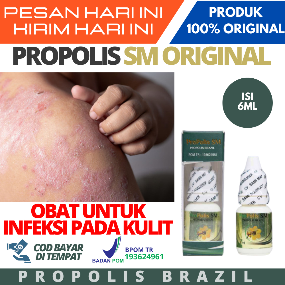 Jual Propolis SM obat tetes herbal untuk Bisul, Infeksi kulit, Benjolan ...