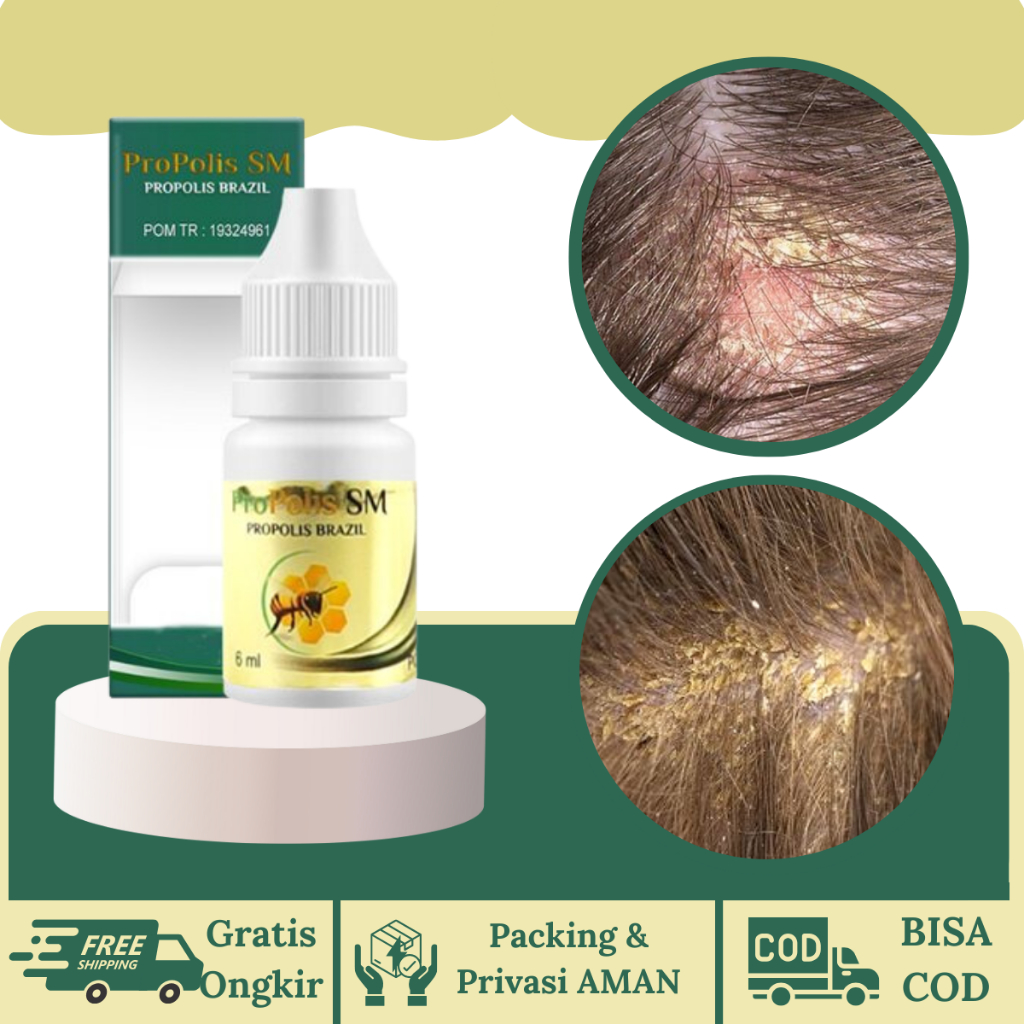 Jual Obat Penghilang Ketombe Berkerak, Obat Ketombe Rambut Rontok Berkerak, Obat Penghilang ...